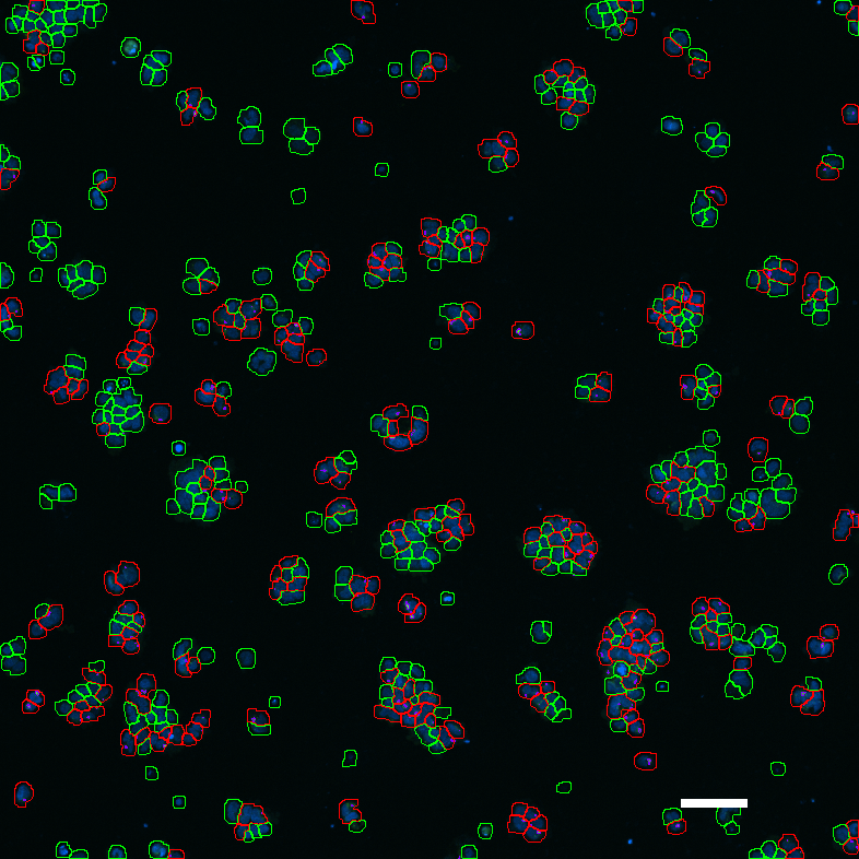 tau seeding – McEwan Lab